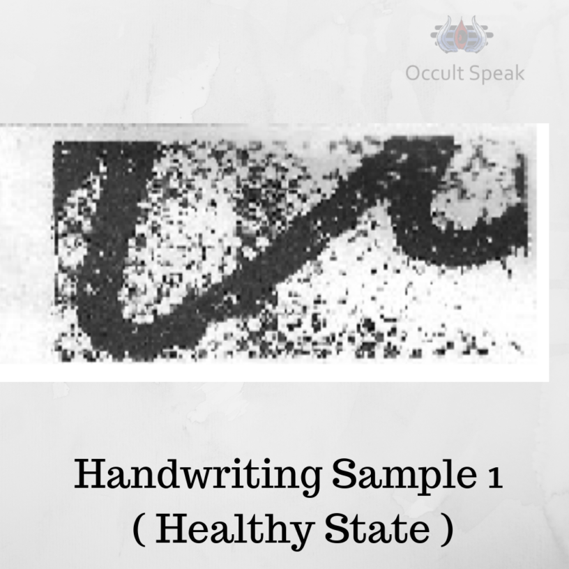 How to detect the Early Stage Cancer by Handwriting